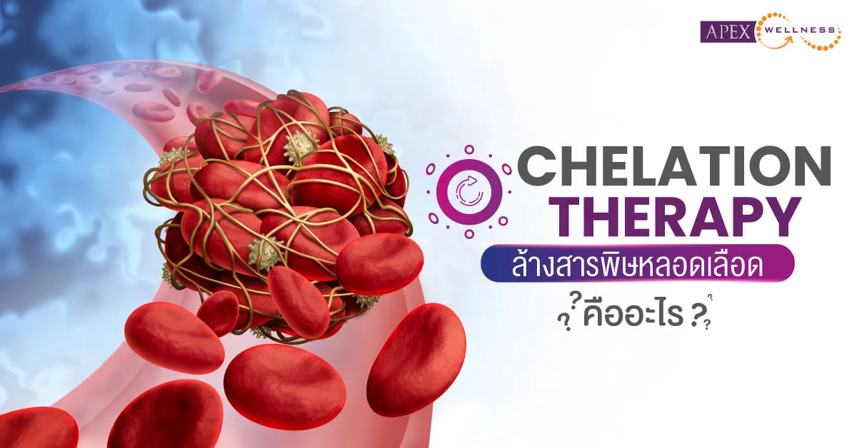 Chelation Therapy ล้างสารพิษหลอดเลือด คืออะไร? ช่วยอะไรบ้าง